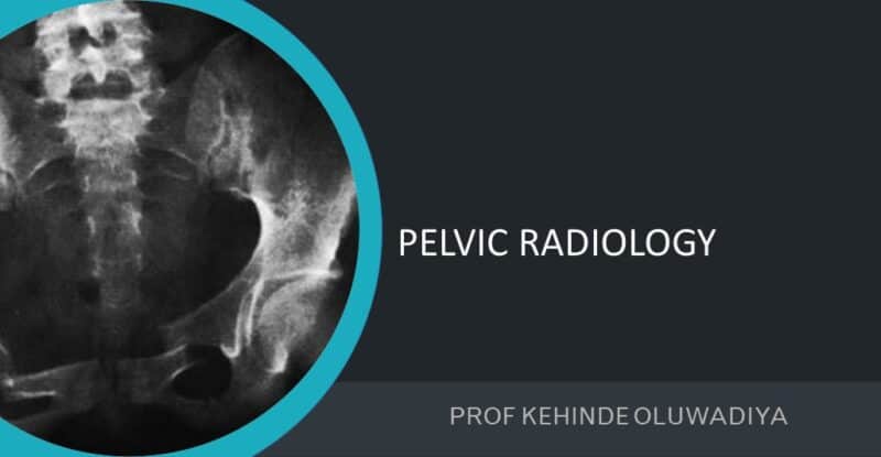 Anatomy: Pelvis and Perineum II - Prof KS Oluwadiya Online